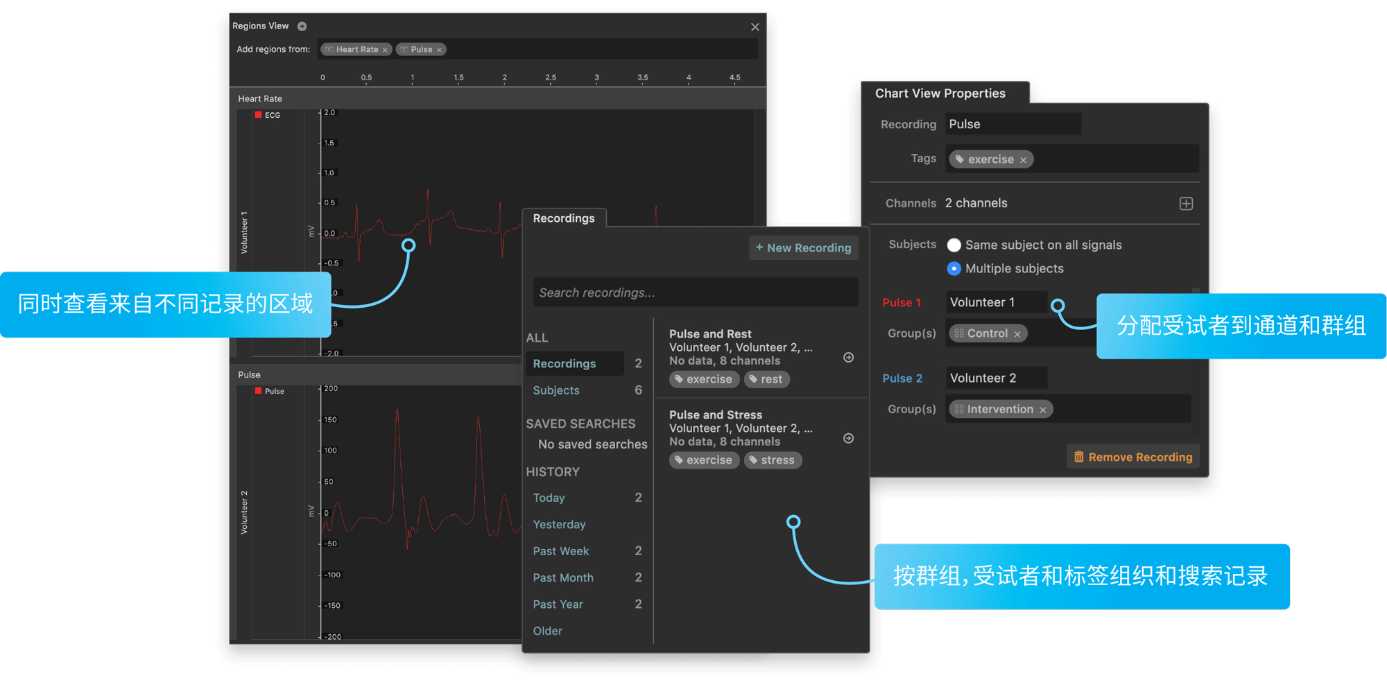 LabChart Lightning - ECG, ECG & EEG Data Acquisition (DAQ) Software ...